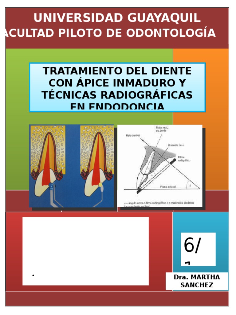 Tratamiento Del Diente Con Ápice Inmaduro | Diente humano | Odontología