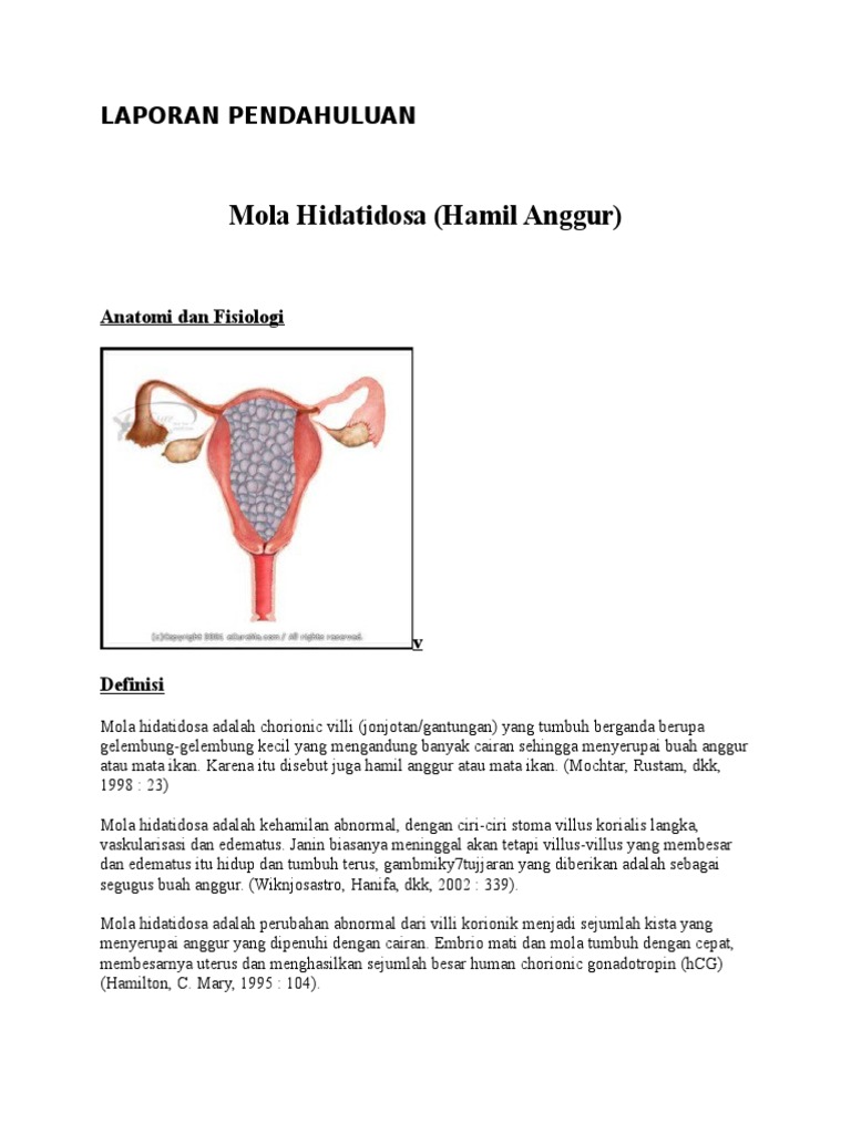 Mola Hidatidosa: Hamil Anggur dan Gejalanya | PDF | Sains & Matematika