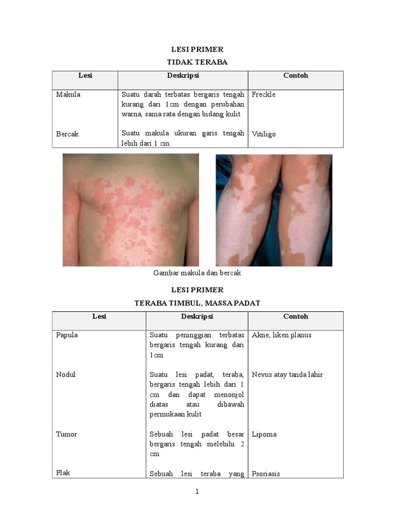 Bahan Lesi Primer | PDF | Seni