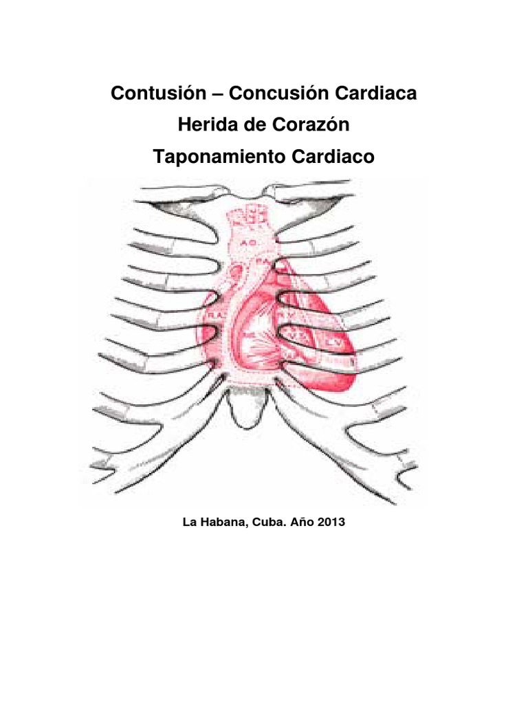 Traumatismo Cardiaco 2 | PDF | Infarto de miocardio | Lesión