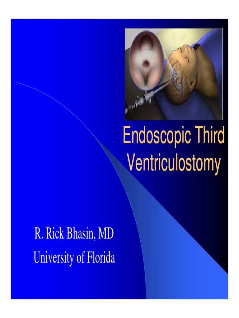 Endoscopic Third Ventriculostomy | PDF | Neurology | Medical Specialties