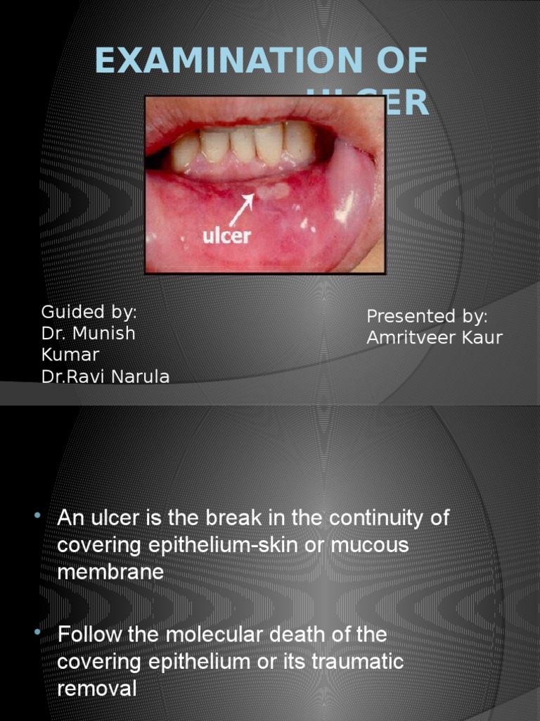 Ulcer Examination Techniques and Types | PDF | Cutaneous Conditions ...