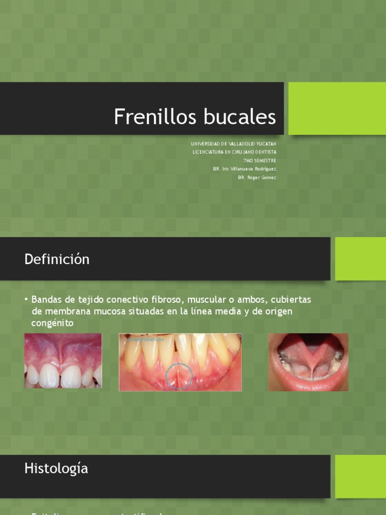 Frenillos Linguales | PDF