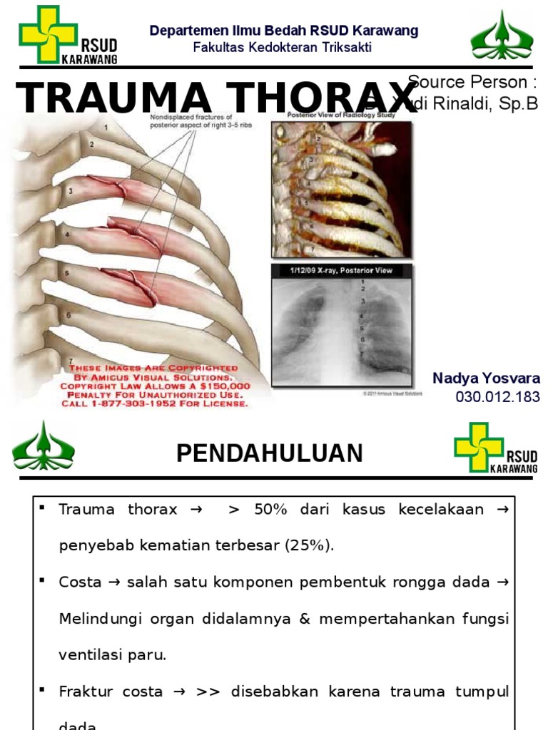 [JUDUL]: "Trauma Thoraks: Penyebab, Gejala Klinis, dan Tatalaksana ...