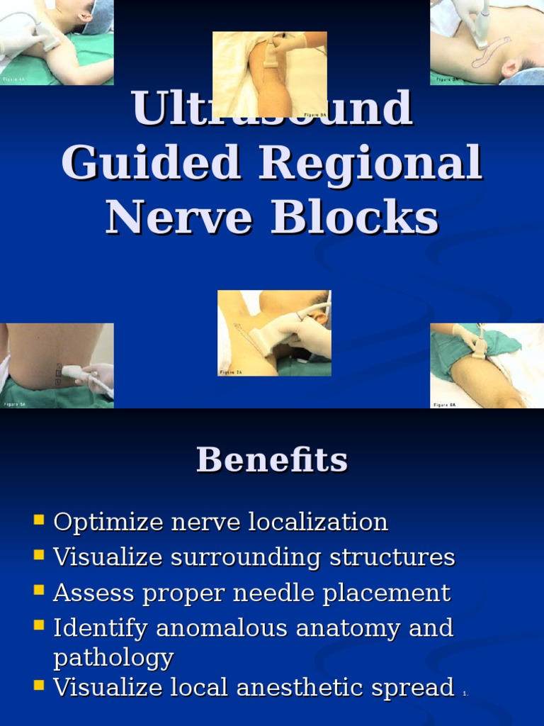 Ultrasound Guided Regional Nerve Blocks | PDF | Anesthesia | Human Leg