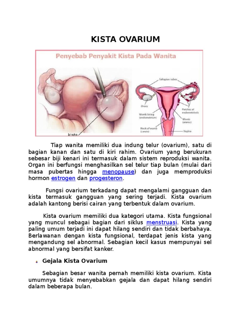 Kista Ovarium | PDF