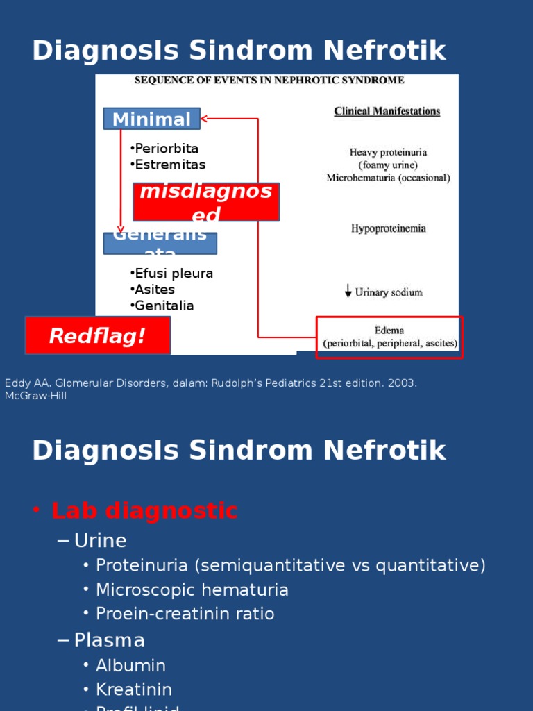DiagnosIs Sindrom Nefrotik | PDF
