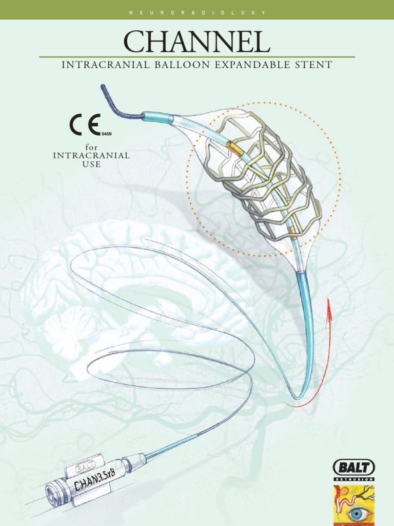 Channel - Intracranial Balloon Expandable Stent | PDF | Cardiovascular ...