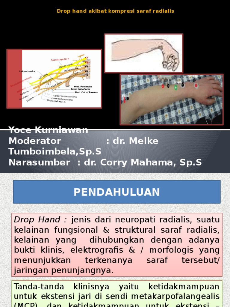 Drop Hand Akibat Kompresi Saraf Radialis | PDF | Sains & Matematika
