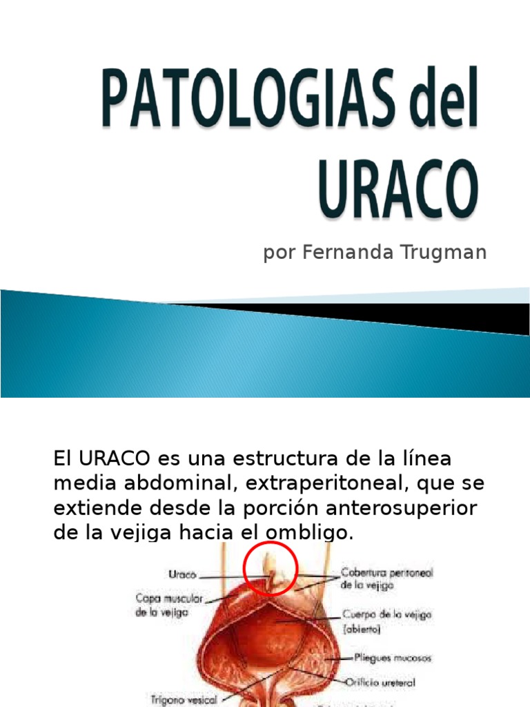 Patologias Del Uraco | PDF