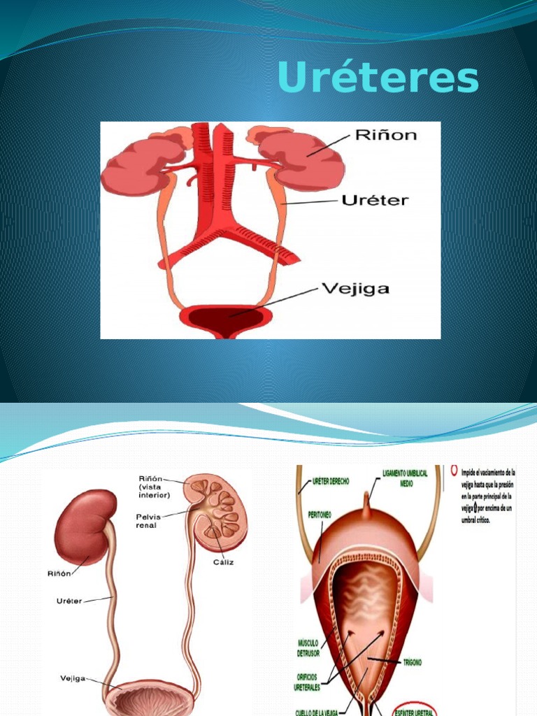 Anatomía y patologías de los uréteres | PDF
