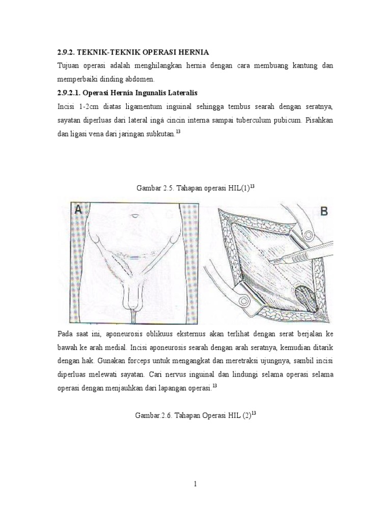Teknik Operasi Hernia | PDF