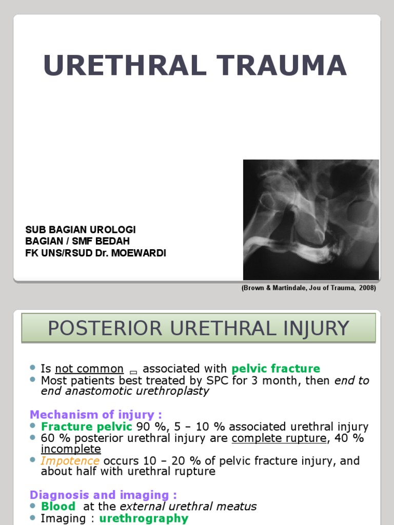 Trauma Urethra | Catheter | Urology