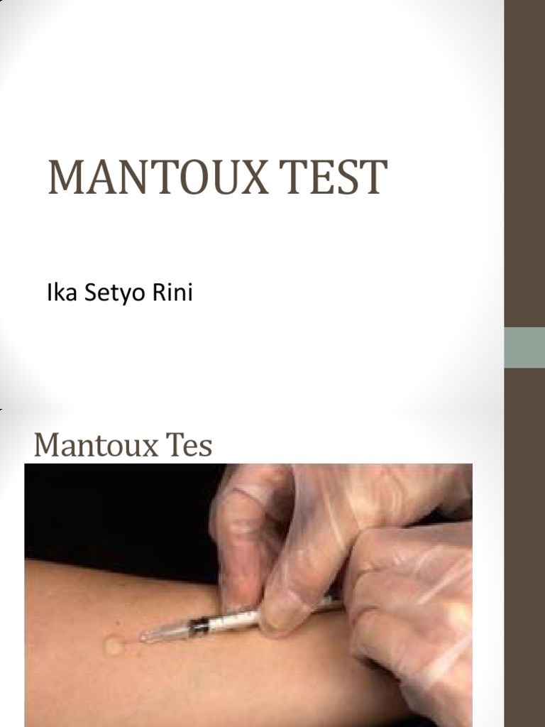 Mantoux Test | PDF