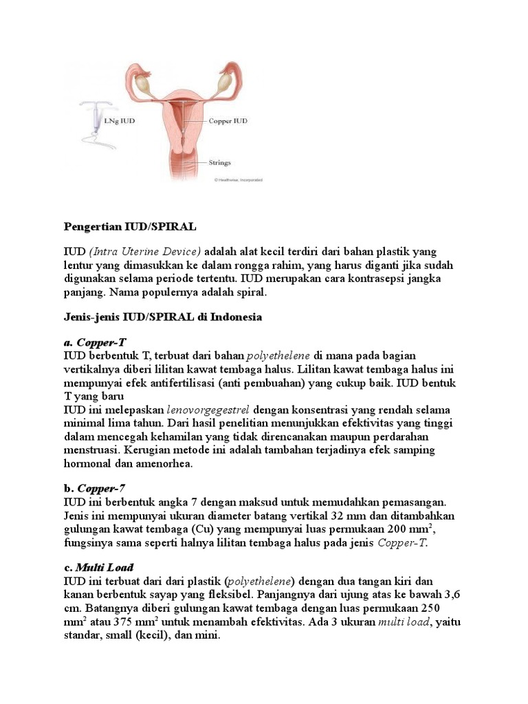Pengertian IUD | PDF