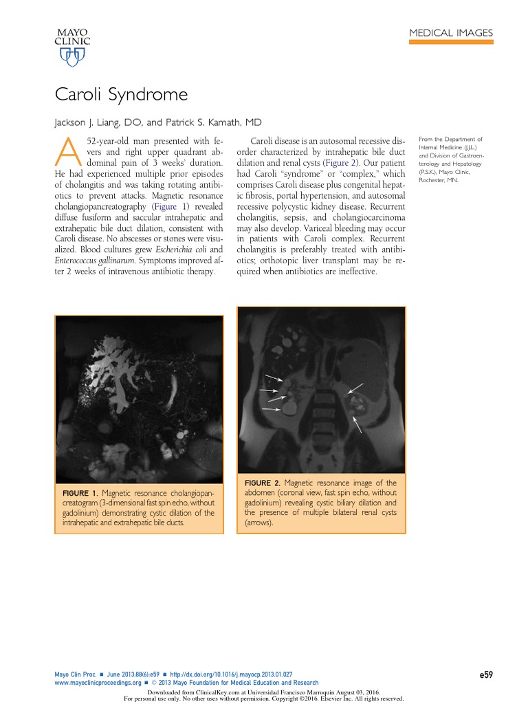 Caroli Syndrome: Medical Images | PDF | Wellness