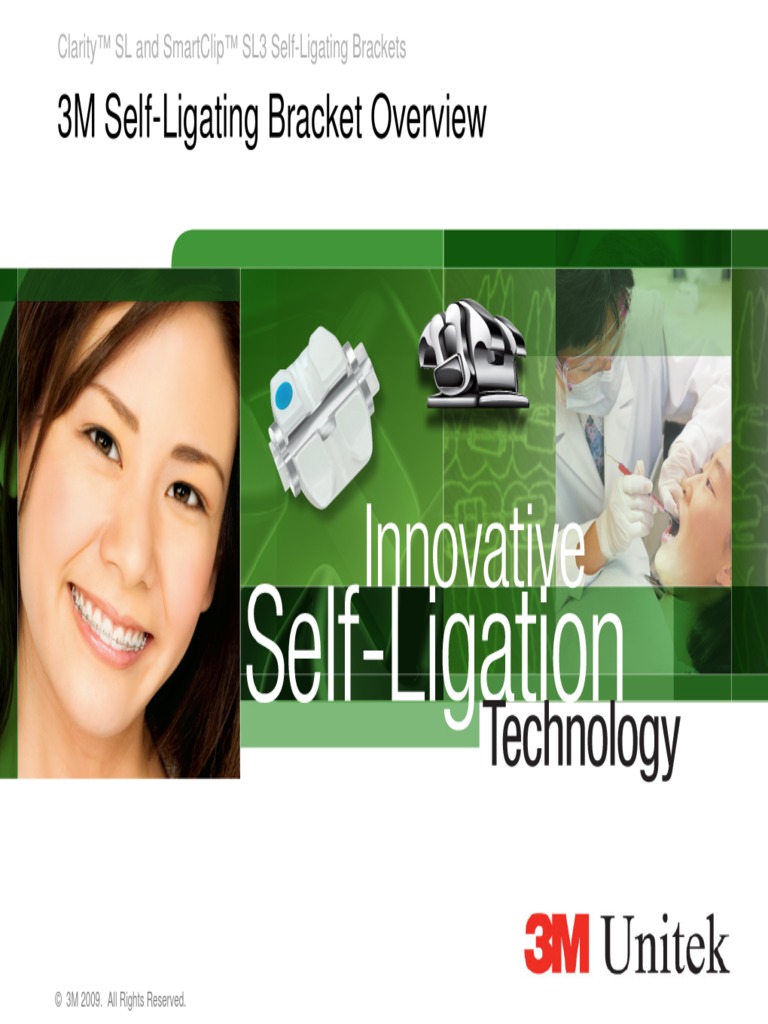 Clarity™ SL and SmartClip™ SL3 Self-Ligating Brackets - 3M Unitek ...