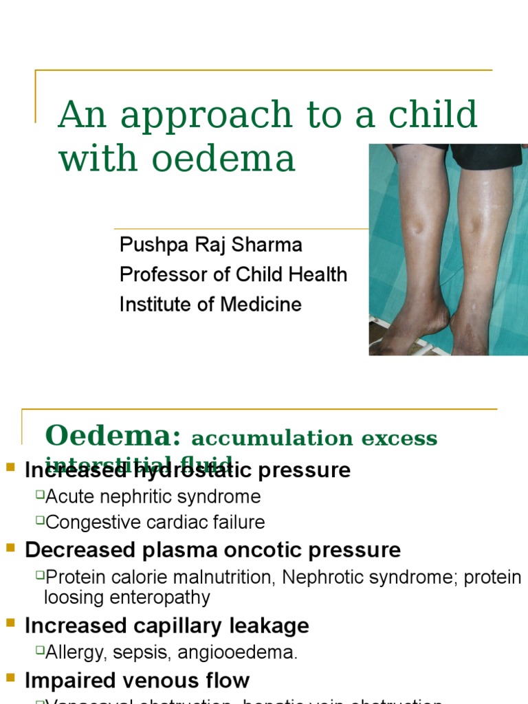 An Approach To A Child With Oedema | PDF | Edema | Medical Specialties