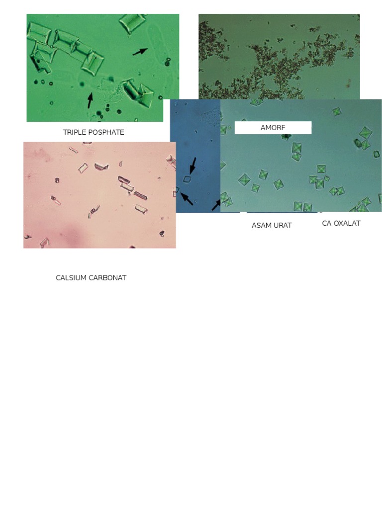 Atlas Sedimen Urine | PDF