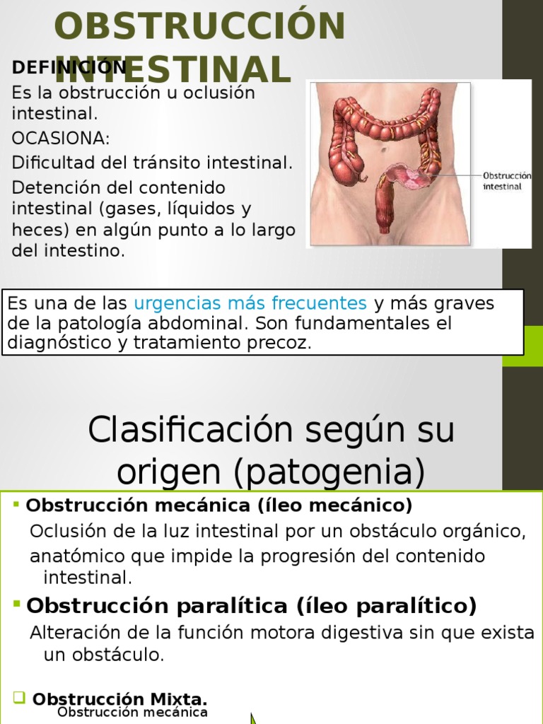 2 Obstrucción Intestinal Presentacion | Descargar gratis PDF | Herida ...