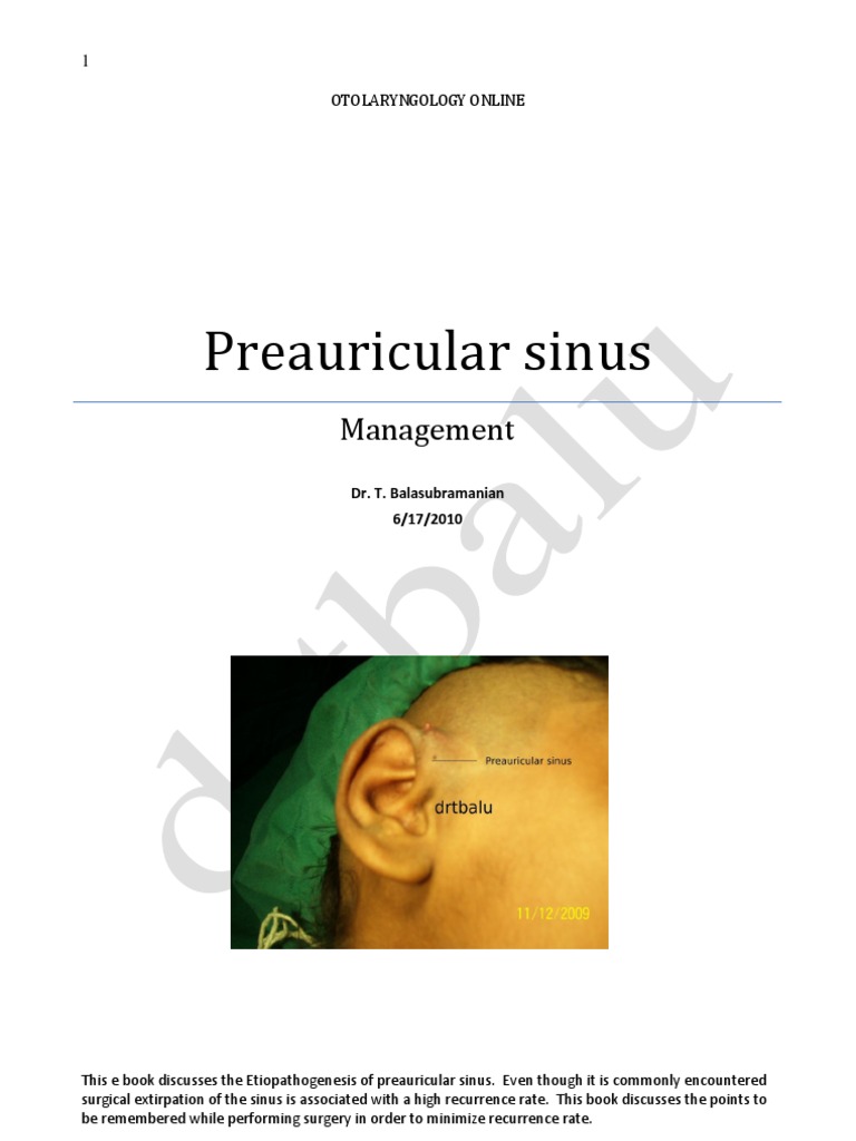 Preauricular Sinus and Its Managment | PDF | Surgery | Ear