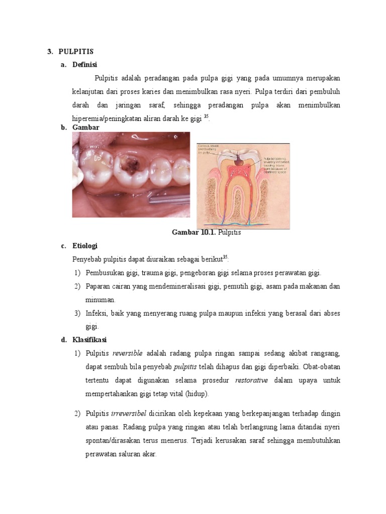 Pulpitis | PDF