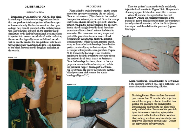 Bier's Block | PDF | Medical Treatments | Health Sciences