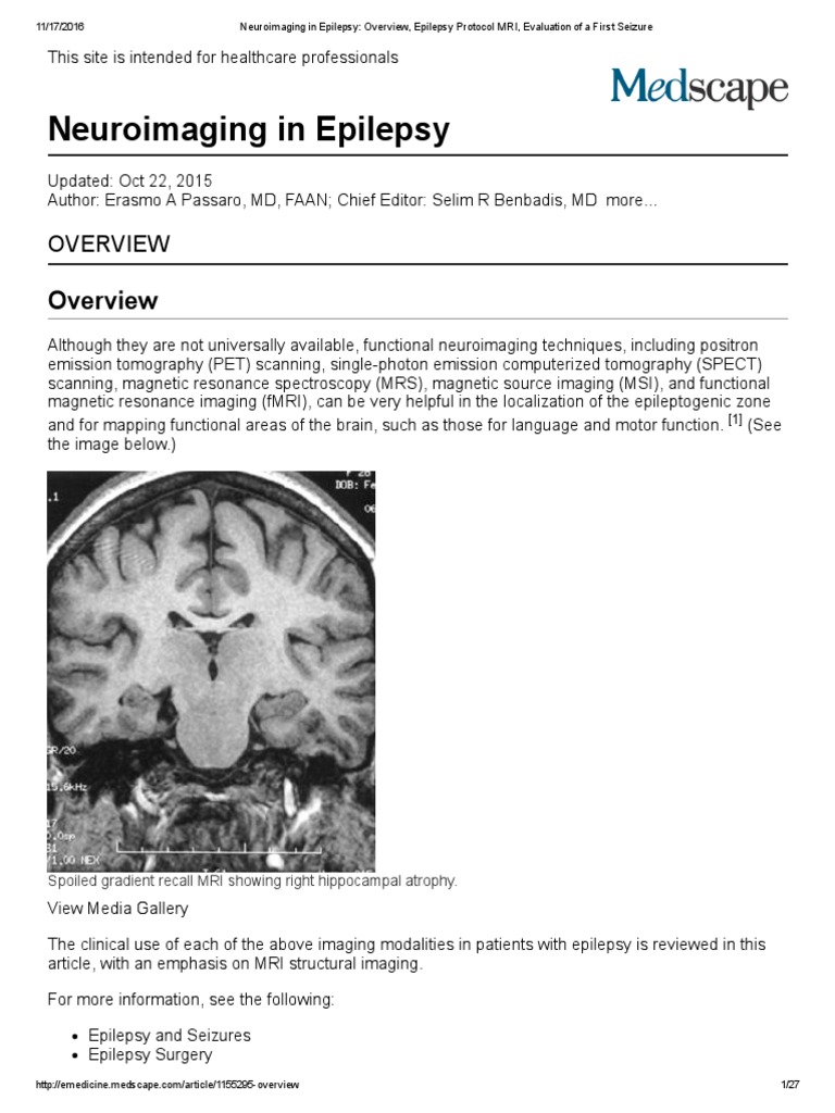 Neuroimaging in Epilepsy_ Overview, Epilepsy Protocol MRI, Evaluation of a First Seizure ...