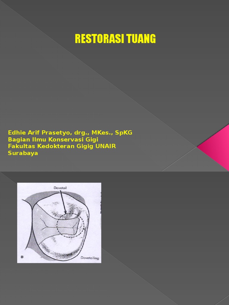 Inlay Dan Onlay S6 2011 | PDF