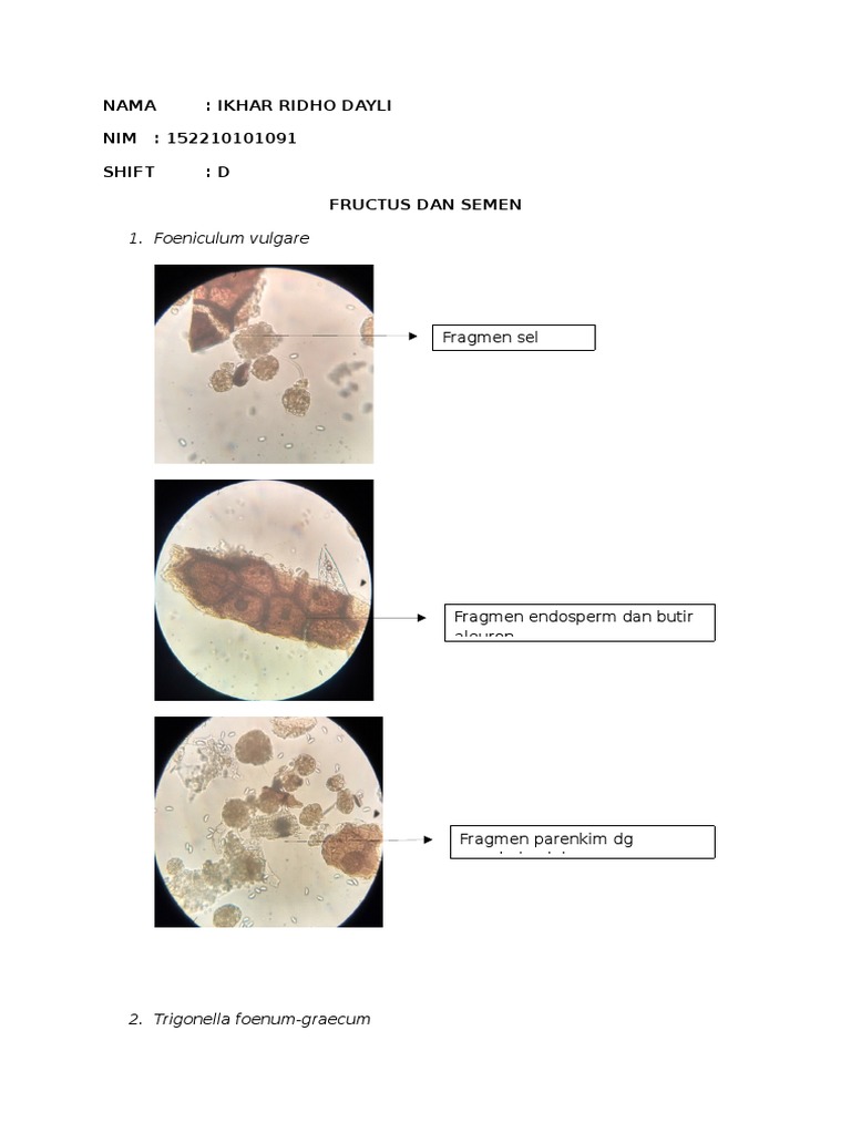 Fructus Dan Semen | PDF