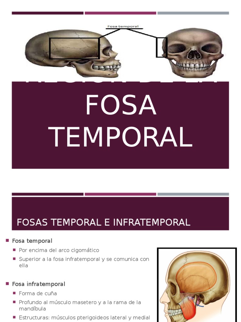 Seminario4 Fosa Temporal