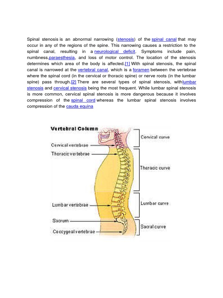 Stenosis Spinal Canal Neurological Deficit Paraesthesia (1) Vertebral ...