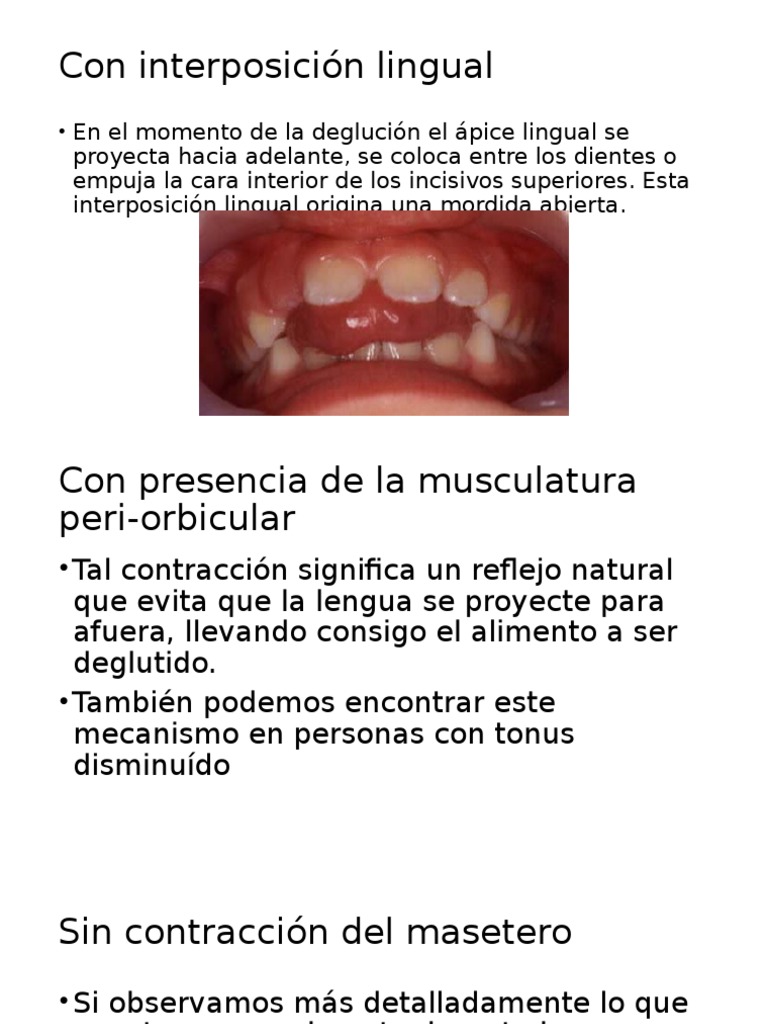 Con Interposición Lingual