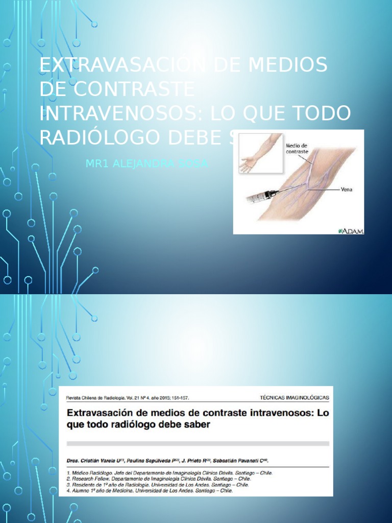 Extravasación de Medios de Contraste Intravenosos | Ct Scan | Ciencias ...