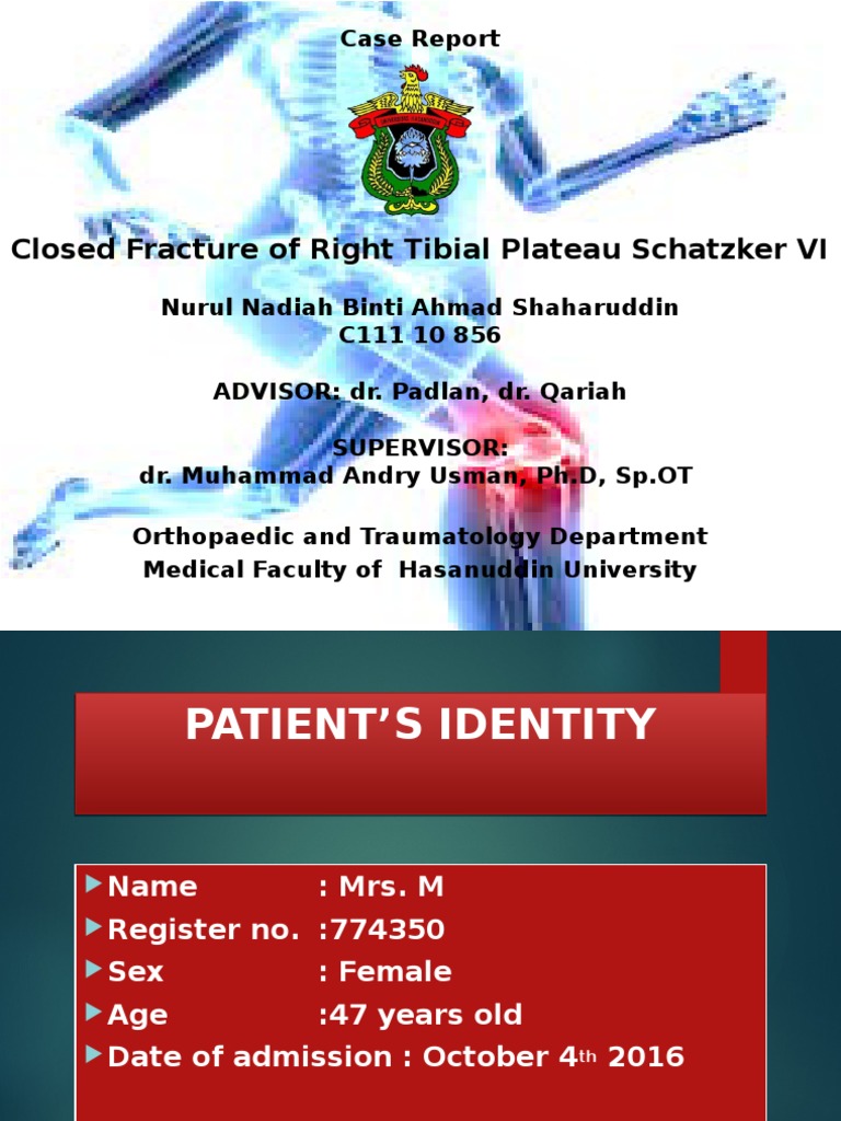 Closed Fracture of Right Tibial Plateau Schatzker VI: Case Report | PDF ...
