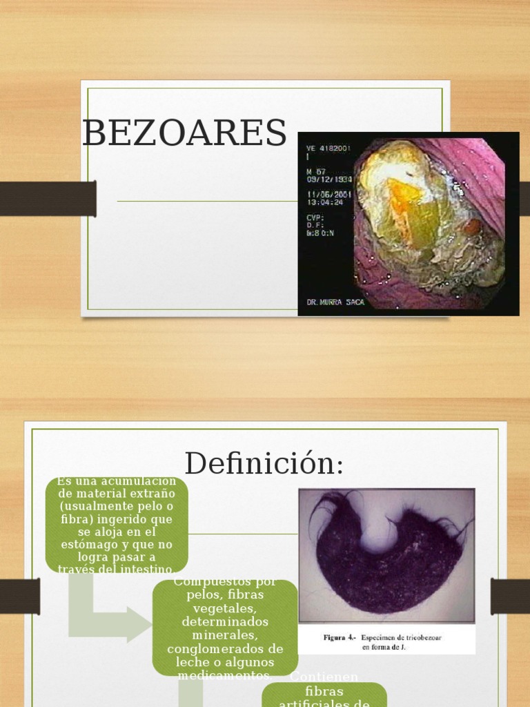 Tricobezoar Expo | PDF | Estómago | Úlcera péptica