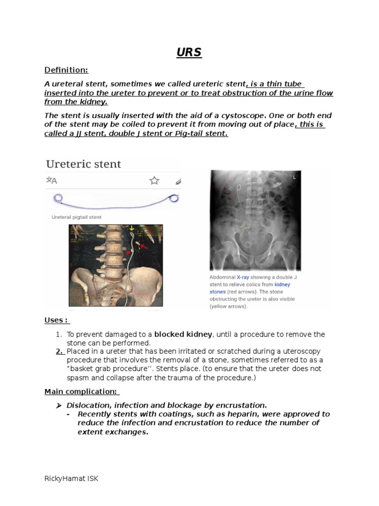 Ureteric Stent (URS) | PDF | Urology | Medical Specialties