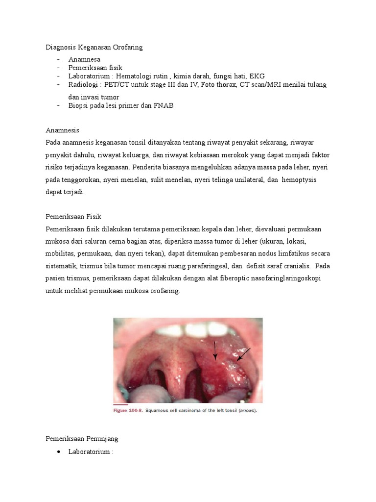 Pemeriksaan Penunjang CA Tonsil | PDF