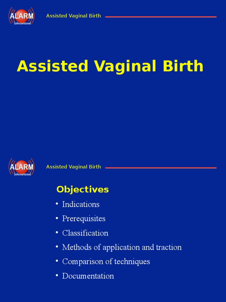 CH13 Assisted vaginal birth.ppt | Childbirth | Women's Health