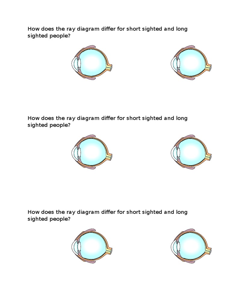 Long Short Sightedness Work Sheet | PDF