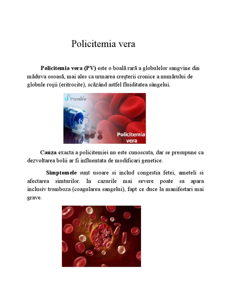 Policitemia Vera | PDF