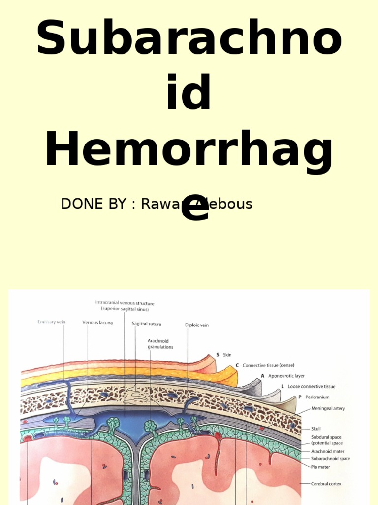 Subarachno Id Hemorrhag E: DONE BY: Rawan Alebous | PDF | Angiology ...
