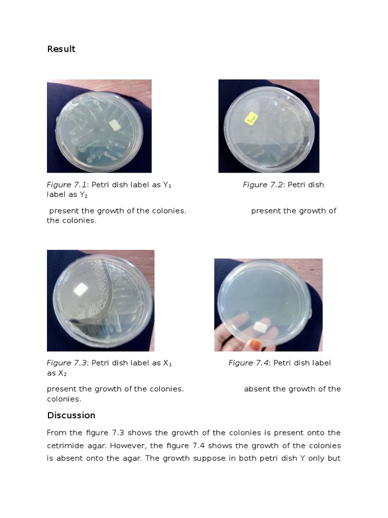 Result: Figure 7.1: Petri Dish Label As Y | PDF | Microbiology ...