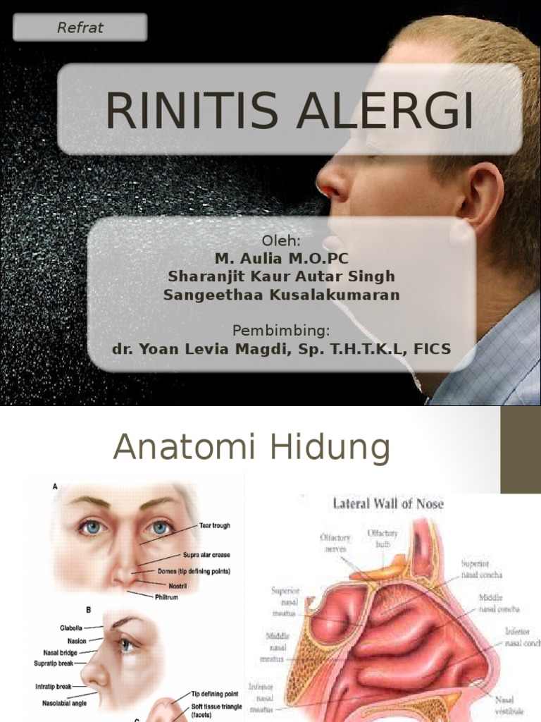 Refrat Rhinitis | PDF