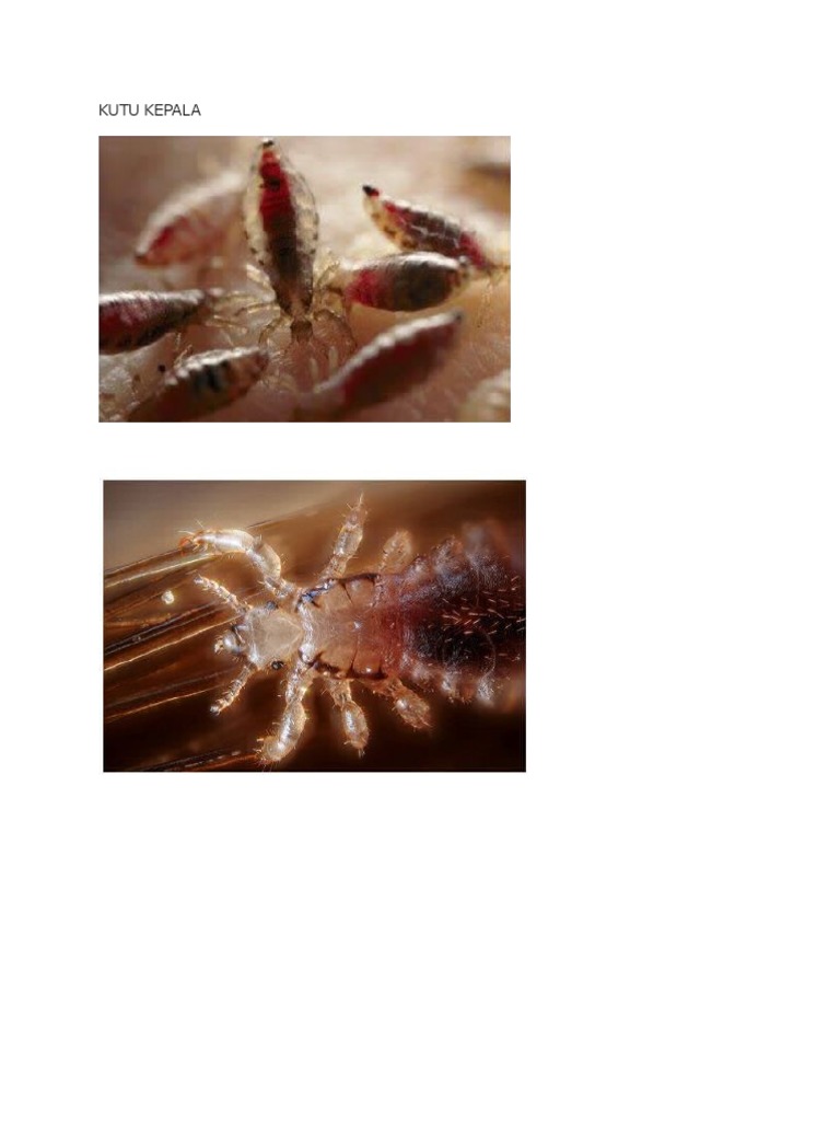 Kutu Kepala | PDF
