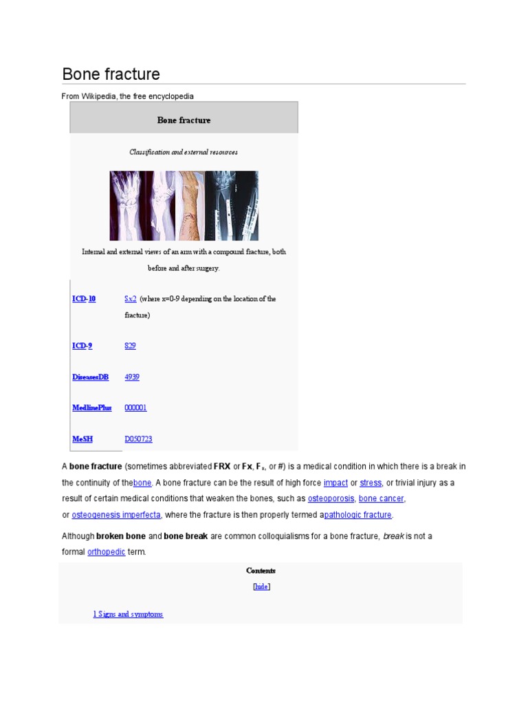 A Comprehensive Overview of Bone Fracture Classification, Diagnosis ...