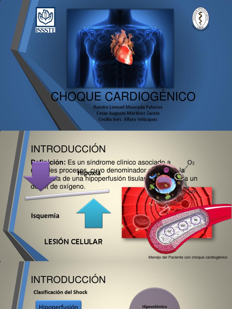 CHOQUE-CARDIOGÉNICO | Choque (circulatorio) | Insuficiencia cardíaca