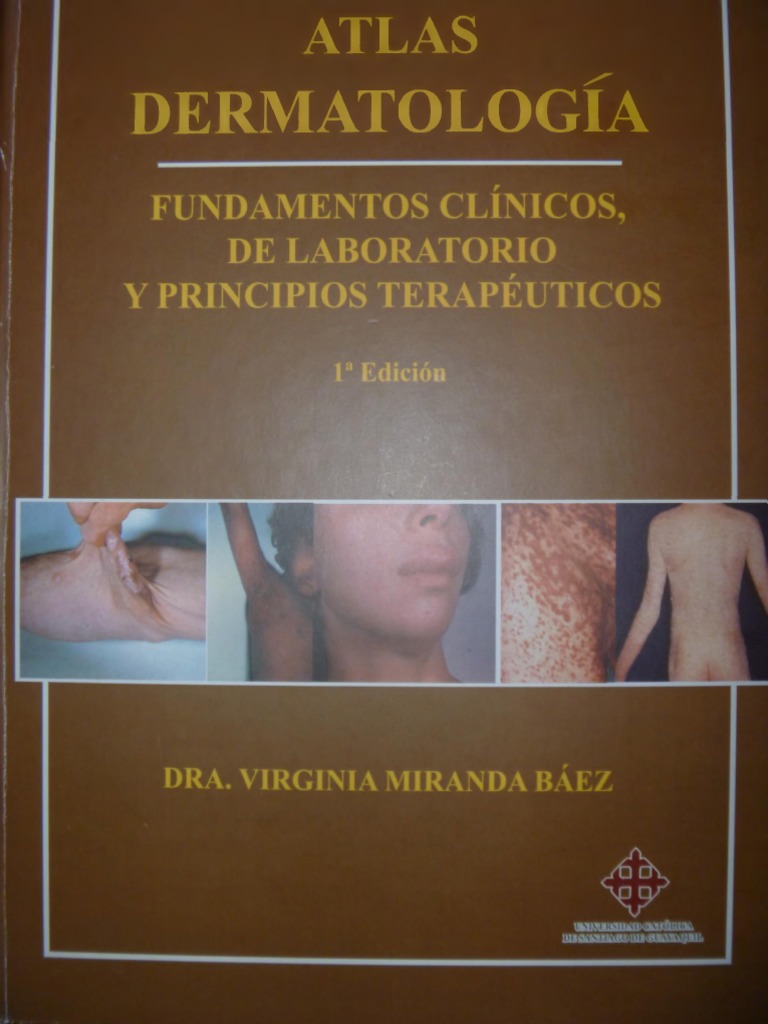 Dermatologia Libro Miranda.pdf | Acné común | Inflamación