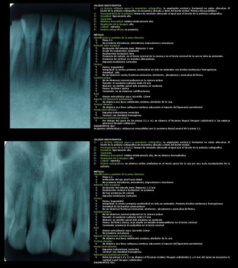 Rx Periapical | Diente humano | Anatomía humana | Prueba gratuita de 30 ...