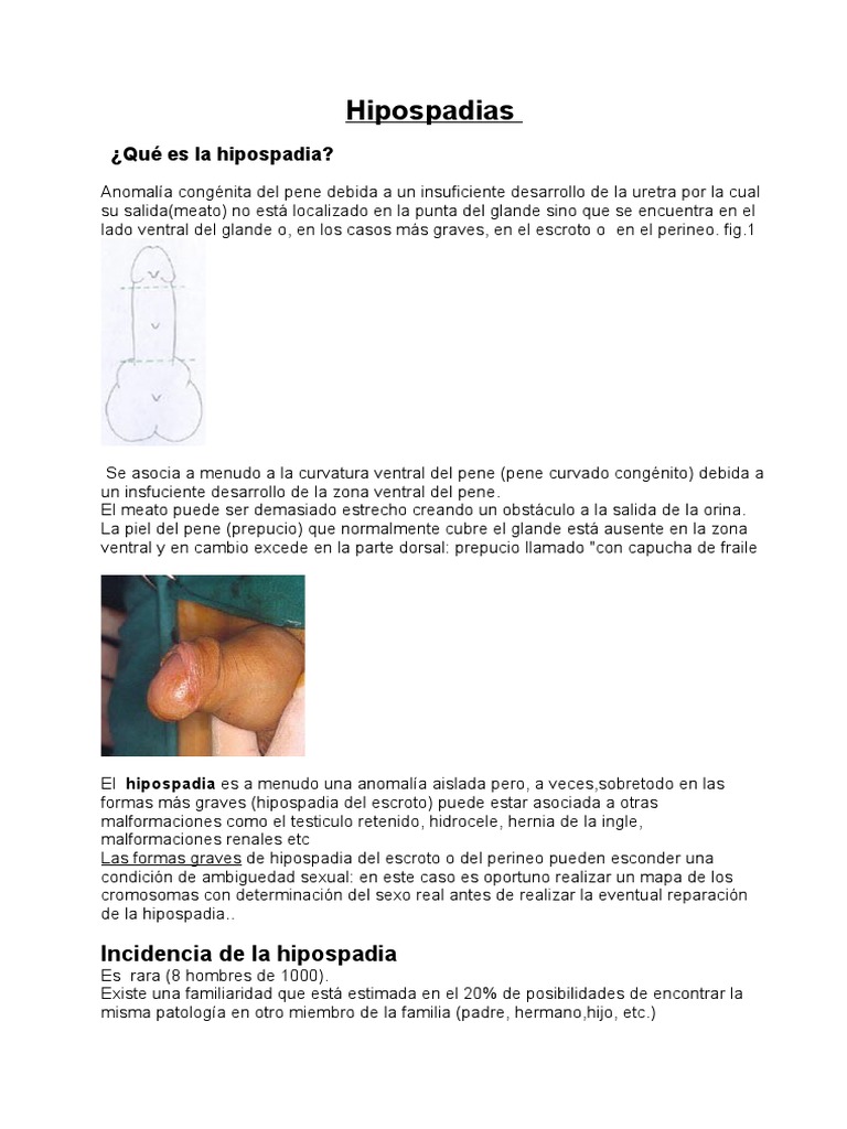 Hipospadia Varios TC | PDF | Urología | Sistema genitourinario